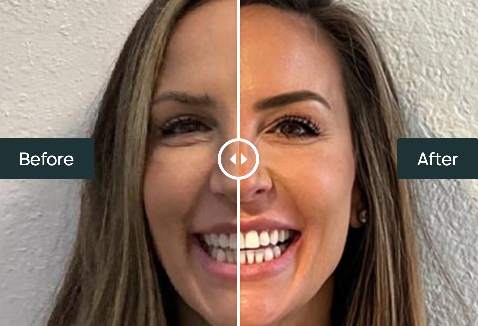 Smile Transformations - Lake Travis Family & Cosmetic Dentistry